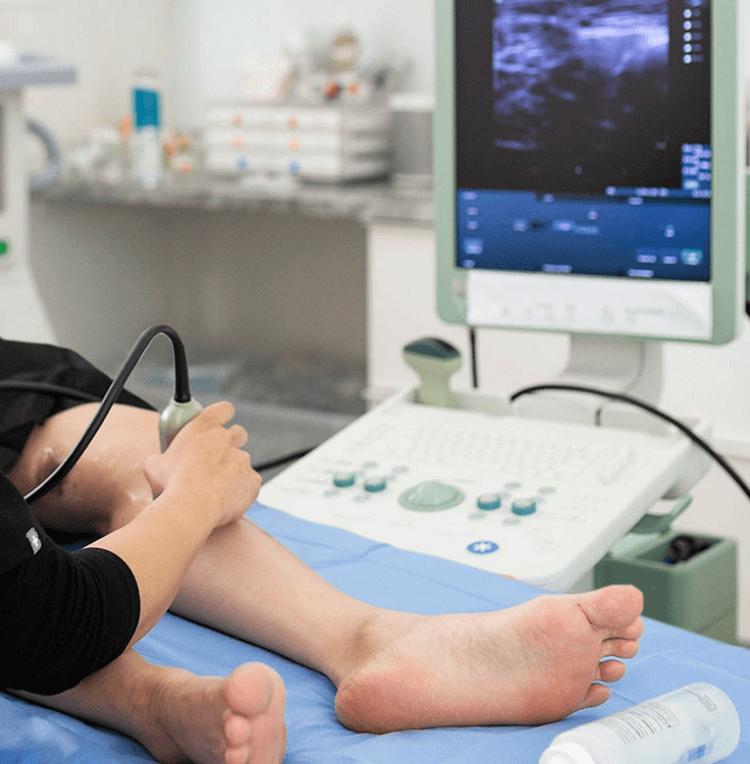 Nationally Recognized Vein Doctor Varicose Vein Removal What You